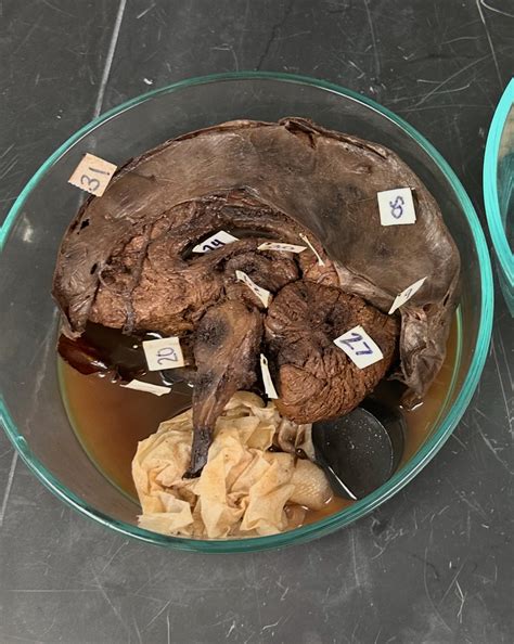 Human Brain Model Diagram Quizlet