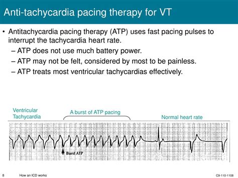 Ppt How An Icd Works Powerpoint Presentation Free Download Id 1145237