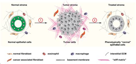 The Role Of Stroma In Tumor Development Pmc