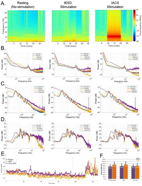 A Eeg Spectrogram Computed For F7 B Spectral Content Of Pre Eo Ec Download Scientific
