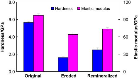 Nanoindentation Hardness And Youngs Modulus Of Enamel Surface Download Scientific Diagram
