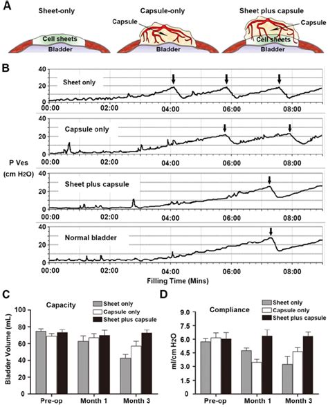 Cystoplasty And Physiologic Bladder Testing A Procedural Schemes For