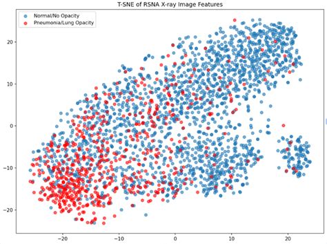 Classification Of Pneumonia In Chest X Rays Using Convolutional Neural Networks A Capstone