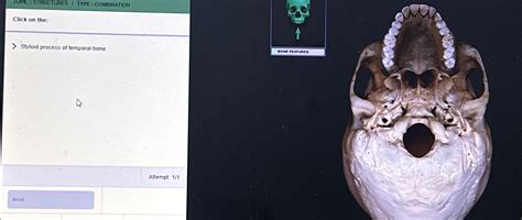 Solved Show Me The Styloid Process Of Temporal Bone Chegg Com