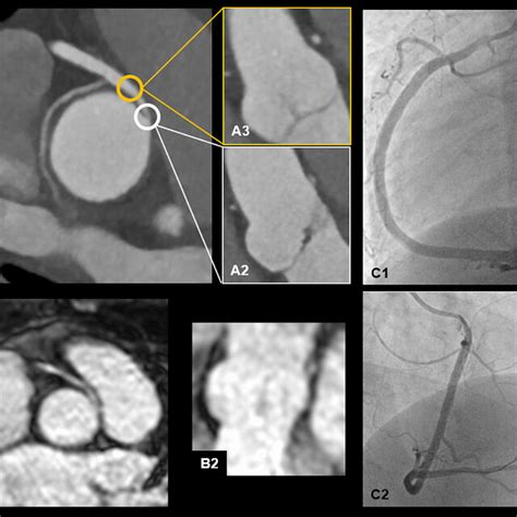 Comparing Imaging Modalities For Anatomy Ccta Cmr And Invasive Download Scientific Diagram