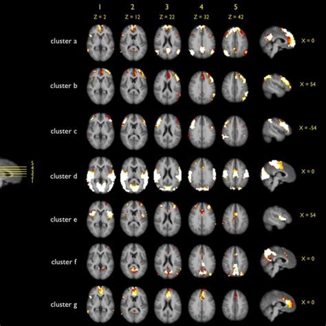 Overlap Of Multiple Group Clusterings Of Different Sets Of Individual Download Scientific