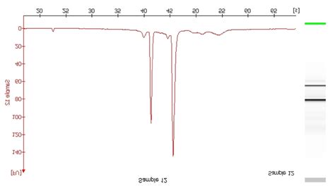 A Representative Bioanalyzer Trace Of Extracted Rna The Low Base Line Download Scientific