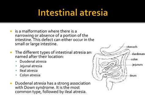 Ppt Approach To Common Pediatric Surgical Problems Powerpoint
