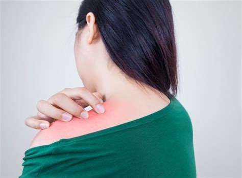 Eritema Mis Remedios