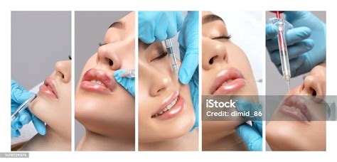 미용사는 아름다운 여성의 비소 주름에 입술 확대 및 안티 주름에 대한 주사를 않습니다 뷰티 살롱의 여성 화장품 Platelet Rich Plasma에 대한 스톡 사진 및
