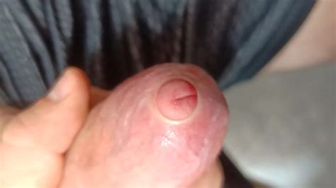 Tight Foreskin Large Cock Play Playing With My Uncut Foreskin Phimosis Cock Xxx Mobile Porno