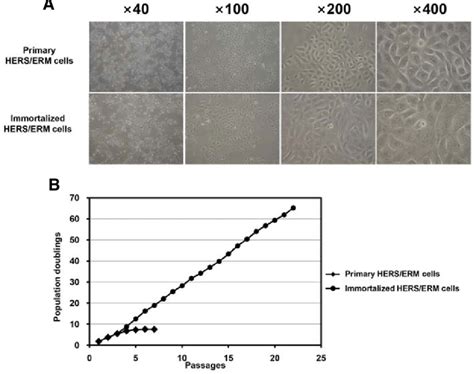 Characterization Of Primary Herserm Cells And Immortalized Herserm Download Scientific