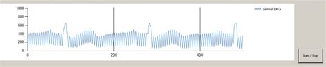 C How To Control The X Axis In Ms Chart Control Time Wise Stack Overflow