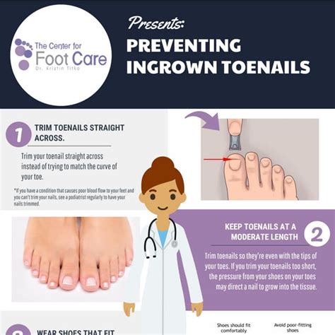 Preventing Ingrown Toenails Pdf