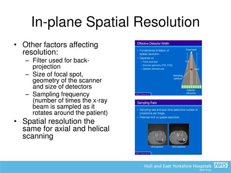 Ppt Ct Scanning Dosimetry And Artefacts Powerpoint Presentation