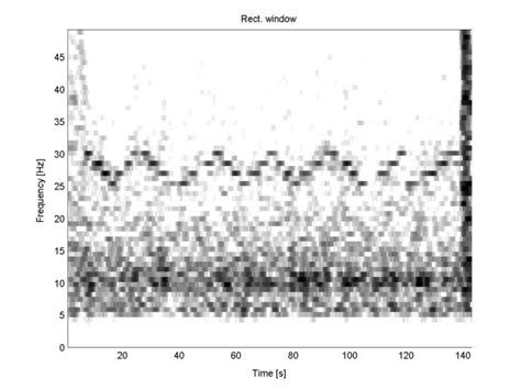 EEG Spectrogram Rectangular Window Download Scientific Diagram