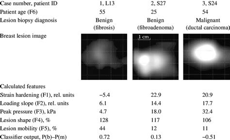 Clinical Examples Of Breast Lesion Imaging And Feature Calculations Download Scientific Diagram