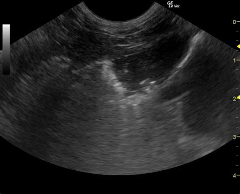 Lung Nodules In A 14 Year Old Mn Dsh Cat Members