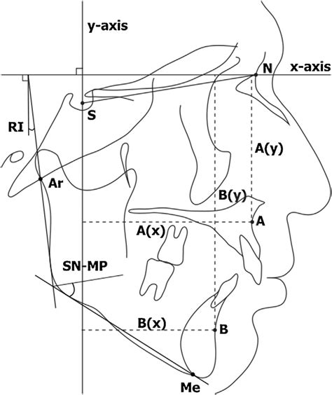 skeletal landmarks reference lines and angles used in the