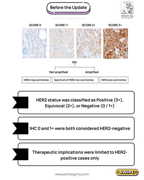 Understanding Low And Ultra Low Her2 In Cap Guidelines Pathology Mcqs