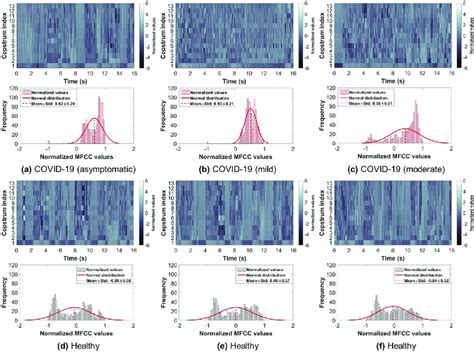 Examples Of The Mel Frequency Cepstral Coefficients Mfcc Extracted