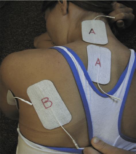 Electrode Placement For Electrical Stimulation Intervention Download