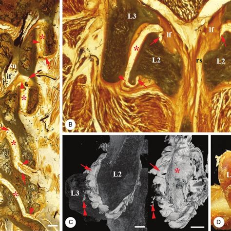 The Facet Joint Fj Recesses At C2 C7 Levels A Sagittal View Of The