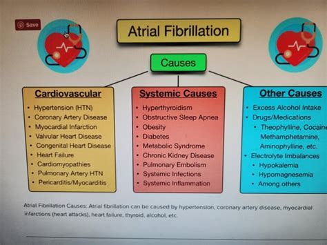 My Heart Always Feels Shakyweirdachey Even When Im Not In Afib And