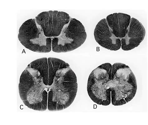 Diagram Of Spinal Cord Region Differences Quizlet