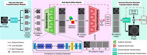 Figure 1 From Fine Perceptive Gans For Brain Mr Image Super Resolution