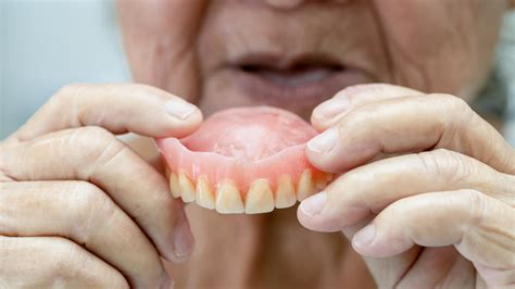 Tipos De Prótesis Dentales Todo Lo Que Necesitas Saber