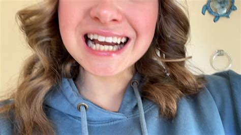 Random Gap After Braces Scrolller