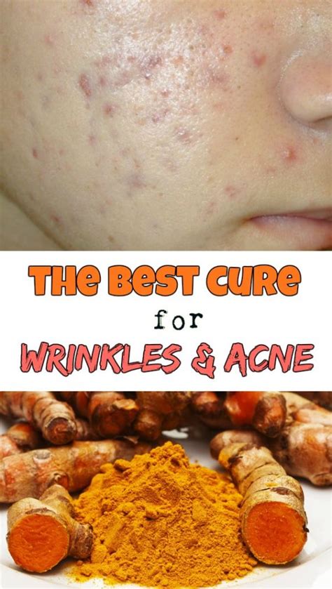 11 Incredible And The Most Effective Beauty Hacks That You Should Know ALL FOR FASHION DESIGN