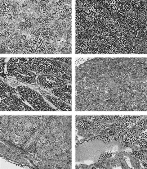 Testes At Maturity Stage Iii In Juveniles Of Triploid Rainbow Trout