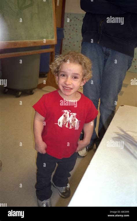 Midget Girl Hi Res Stock Photography And Images Alamy