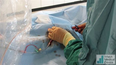 Merit Medical Systems Inc On Linkedin Swift Ninja Microcatheter Use