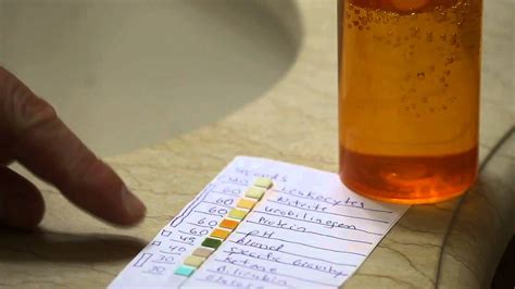 Urine Specific Gravity Lab Value Andmoretews