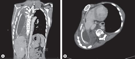 Pediatric Chest And Trunk Deformities Clinical Tree