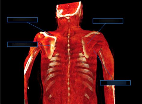 Module 6 Part 3 Diagram Quizlet