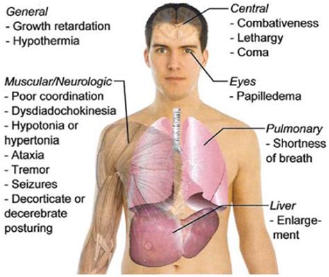 Metabolism Of Amino Acids Clinical Tree