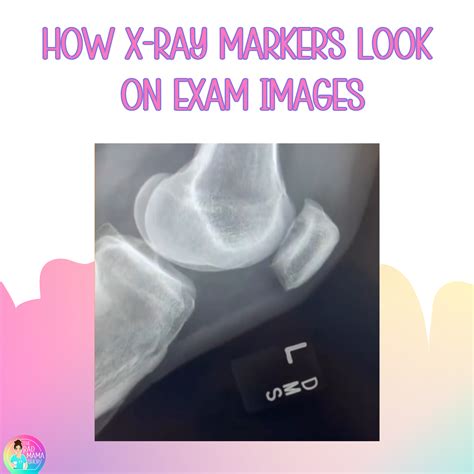 X Ray Markers With Initials For Radiology Technologists The Rad Mama Shop