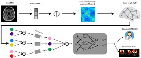 [논문 리뷰] gkan explainable diagnosis of alzheimer s disease using graph neural network with