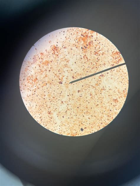 Please Help R Microbiology