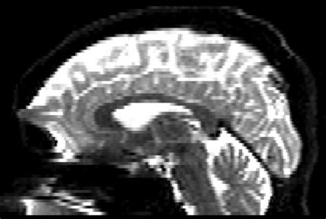 Dti Tutorial 1 From Scanner To Tensor Diffusion Imaging Introduction Tutorials And