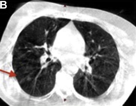 Cbct Seg Instance Segmentation Dataset And Pre Trained Model By Congliutest