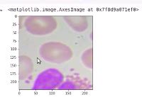Blood Cell Detection In Image Using Naive Approach Analytics Vidhya