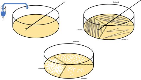 Serial Dilutions And Plating Microbial Enumeration Jove