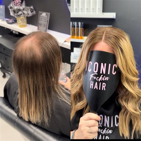 Mesh Integration Iconicfckinhair