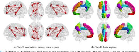 Figure 1 From Graph Self Supervised Learning With Application To Brain Networks Analysis