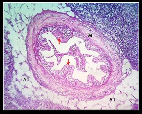 Pancreatic Duct Histology